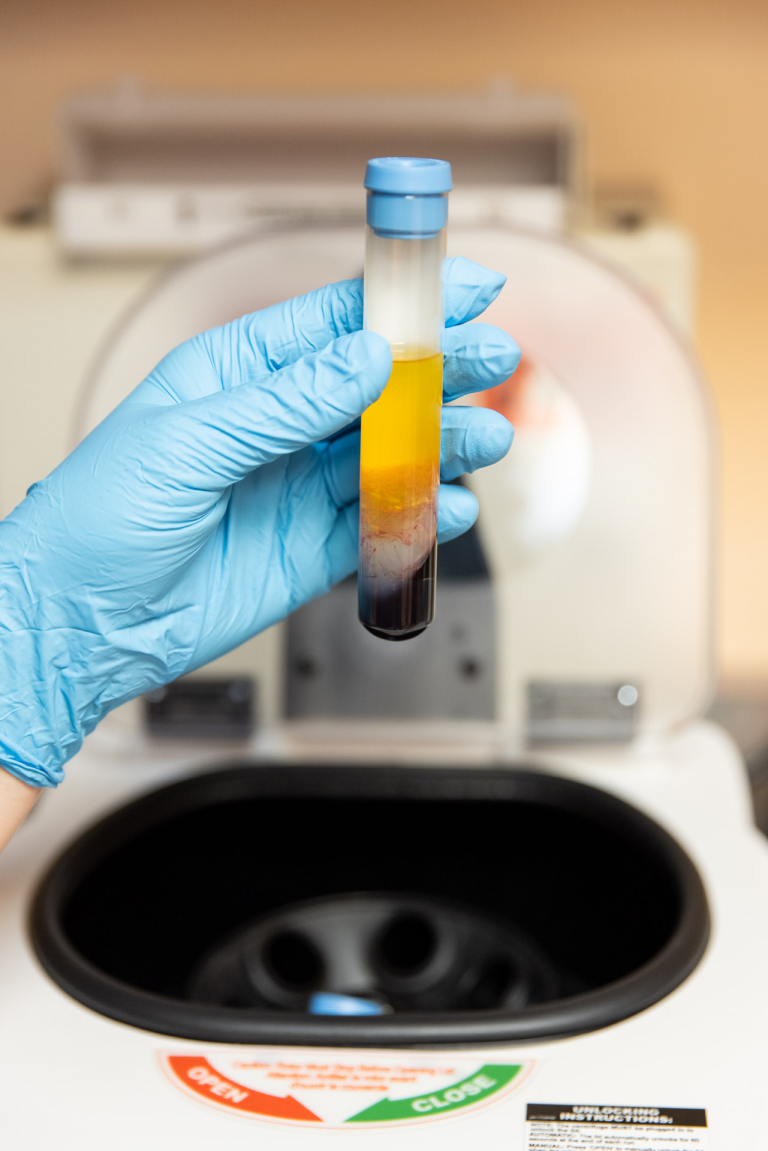 O-Shot in Winter Garden | Horizons OBGYN & Aesthetics