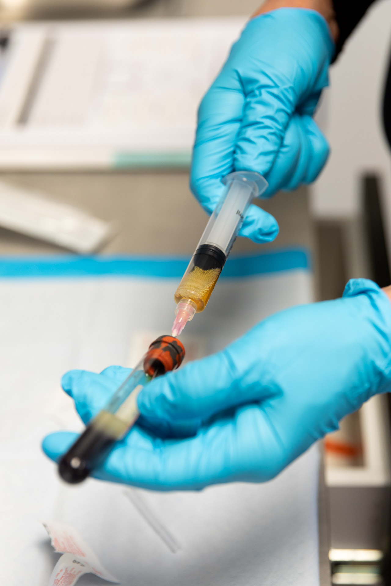 PRP Injections in Winter Garden | Horizons OBGYN & Aesthetics